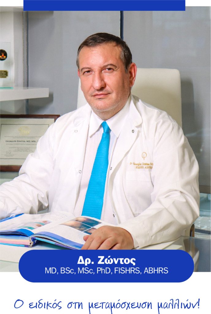 Μεταμόσχευση μαλλιών - Zontos Hair & Skin Clinic
