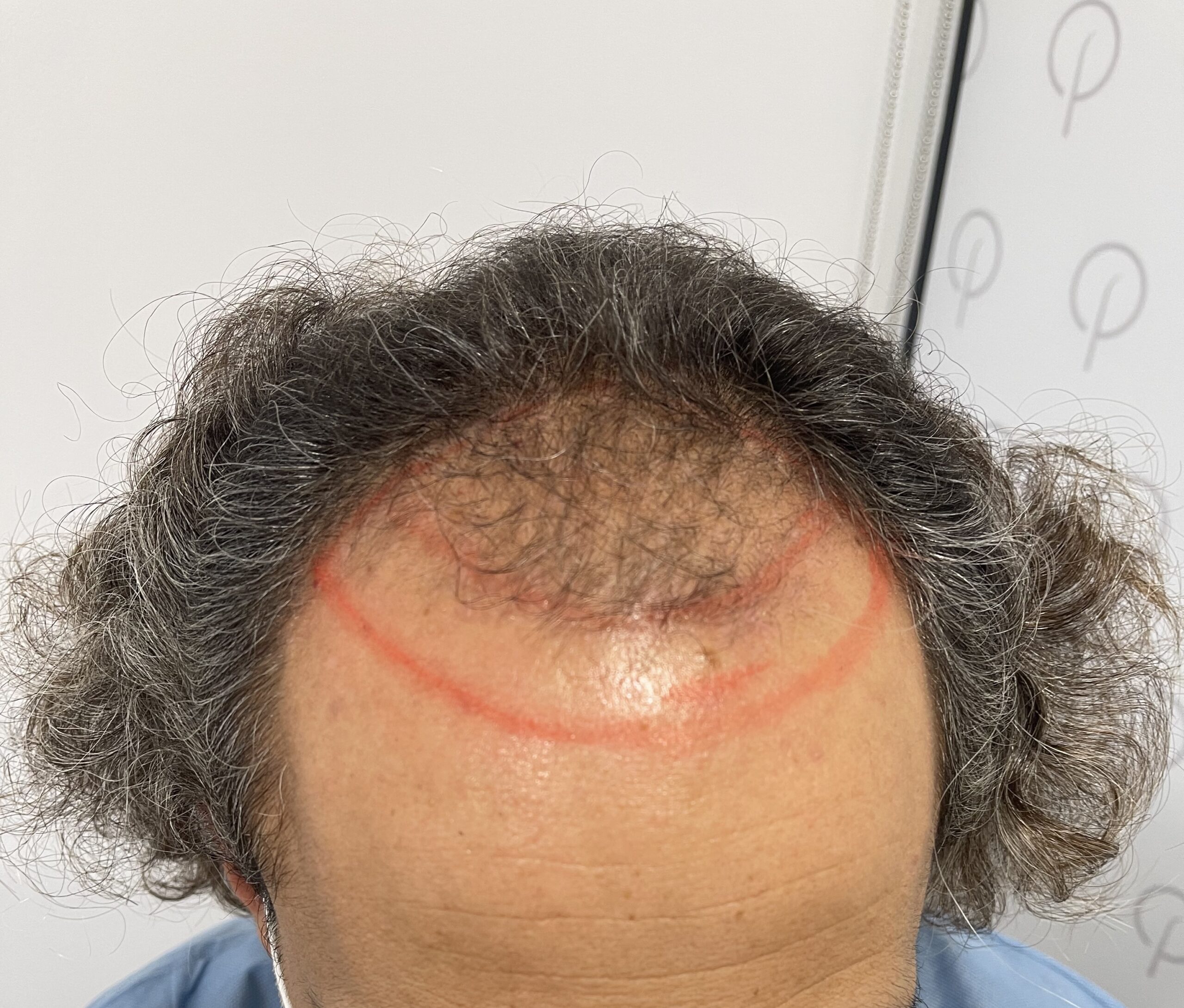 LUL - zontoshairclinic.com